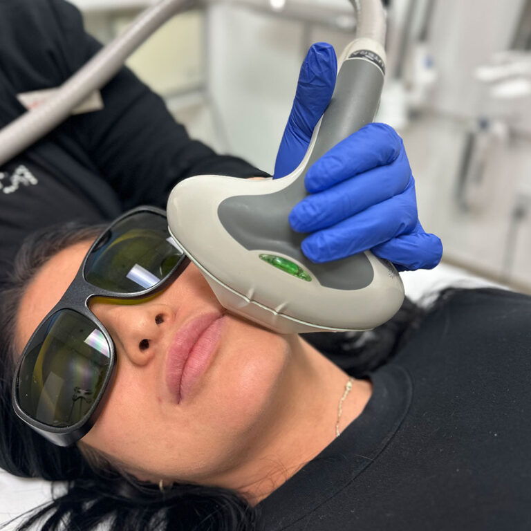 IPL Treatment Houston - IPL Skin Rejuvenation River Oaks TX