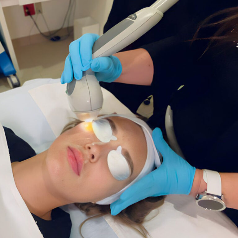 IPL Treatment Houston - IPL Skin Rejuvenation River Oaks TX